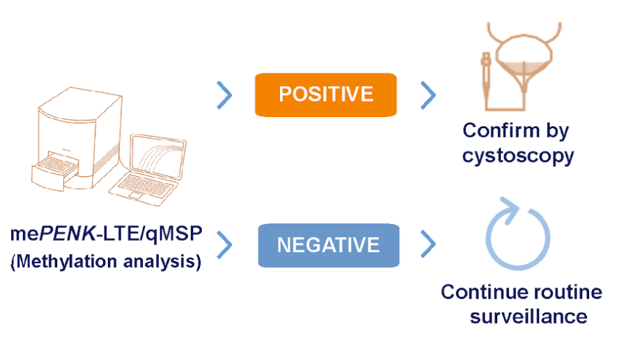 Simple Noninvasive Test May Lead to Breakthrough in Early Diagnosis of ...